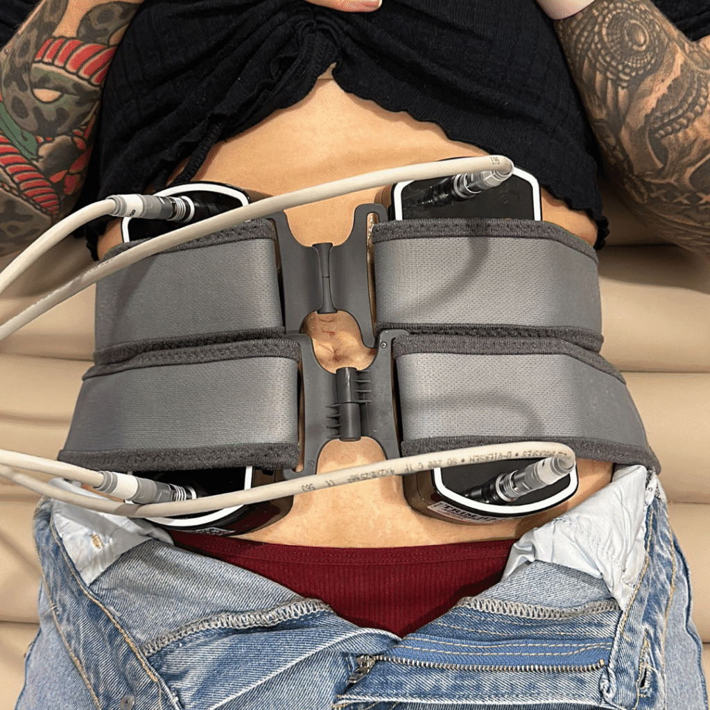 EvolveX Body Contouring in Gawler, South Australia